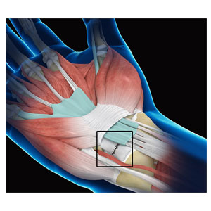 Wrist Ligaments Mri