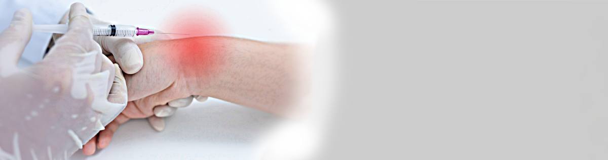 Trigger Point Injection - Academy Orthopedics