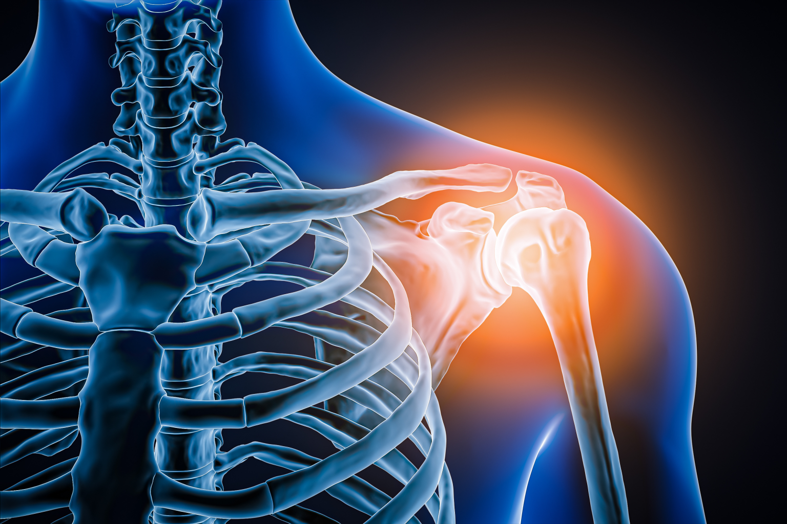 Preparing For Rotator Cuff Repair Surgery Academy Orthopedics 2122